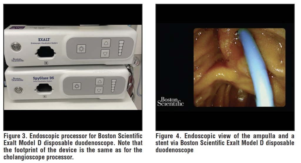Disposable Endoscopes: Current Status and Future Directions - Practical ...