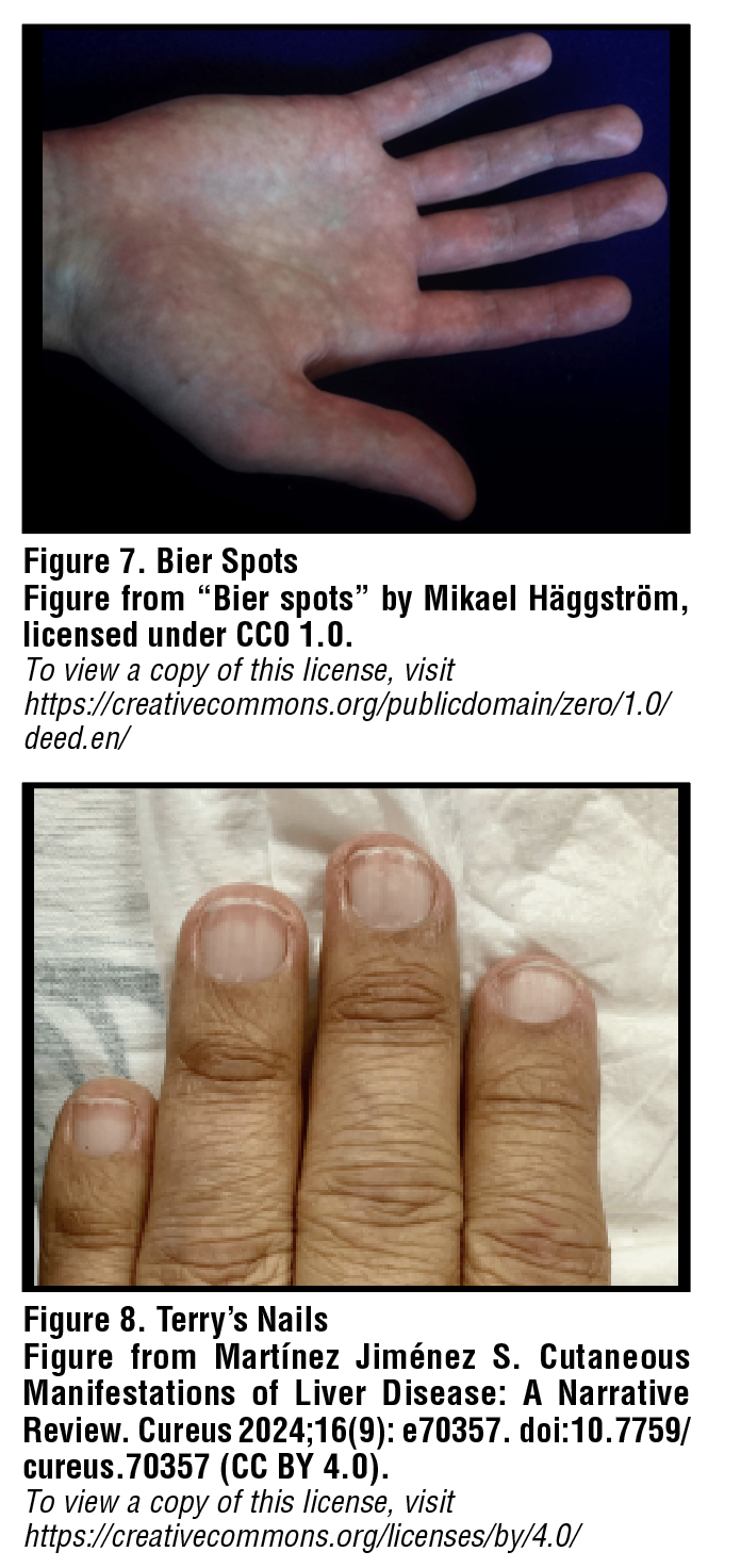 Beyond Jaundice Part 1: Identifying and Describing Cutaneous ...